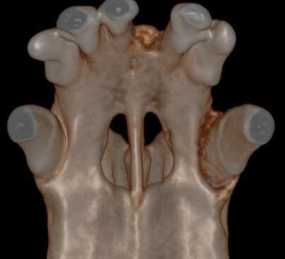 Guided Tissue Regeneration (GTR)