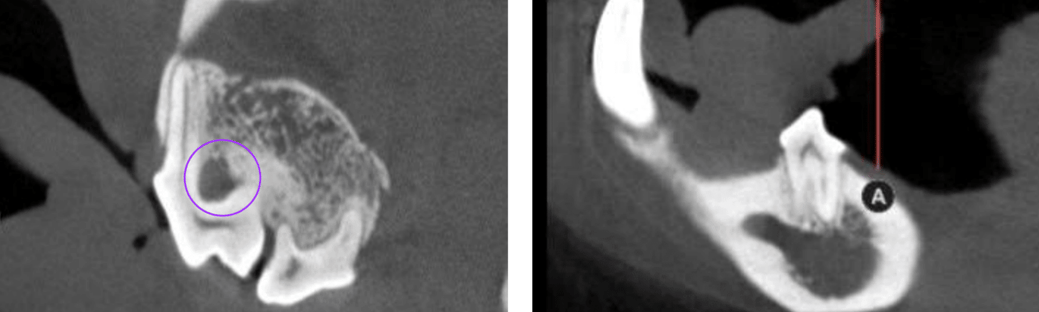 Canine Chronic Ulcerative Stomatitis (CCUS)