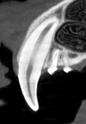 Non-Vital Teeth: How Root Canal Therapy Can Help